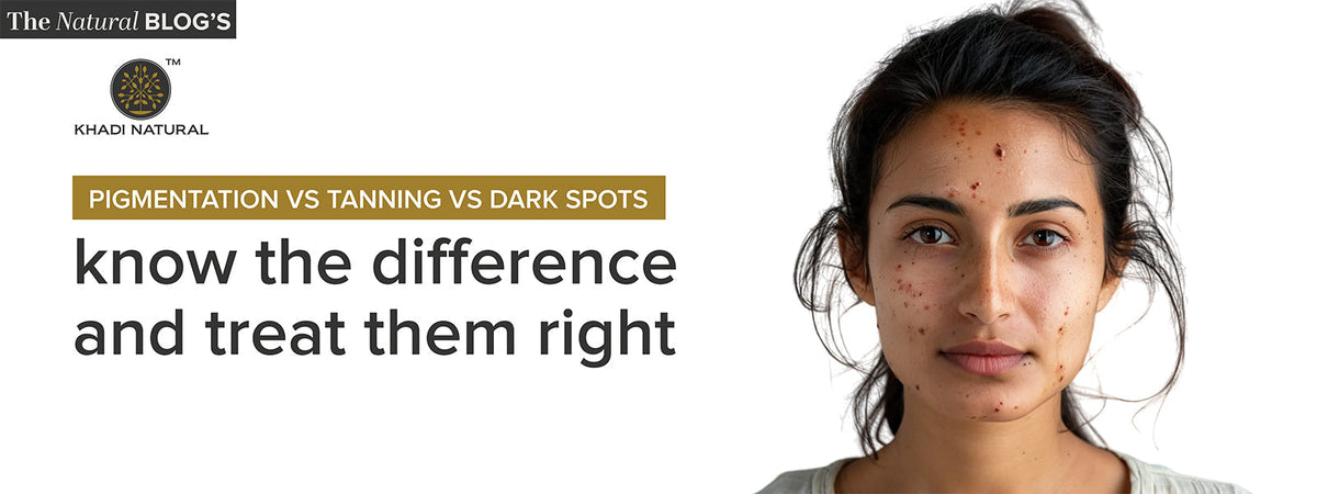 Pigmentation vs. Dark Spots vs. Tanning: Know the Difference & Treat T
